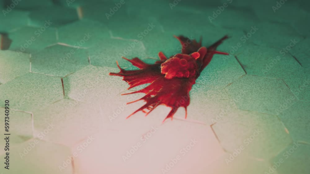 Cancer cells grow and reproduce uncontrollably in the human body ...