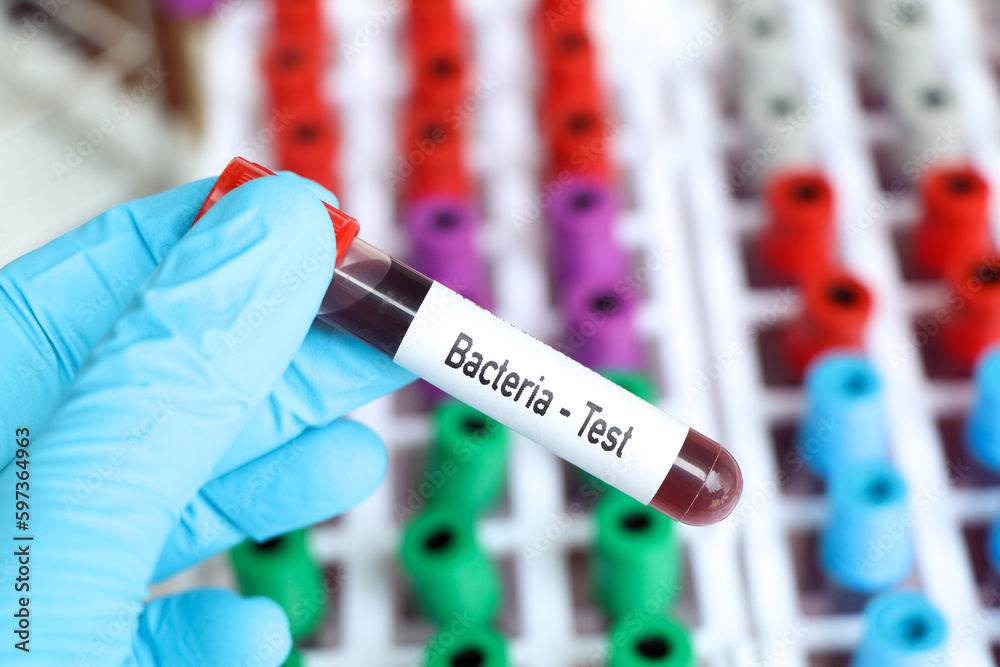 Bacteria test, blood sample to analyze in the laboratory Stock Photo ...