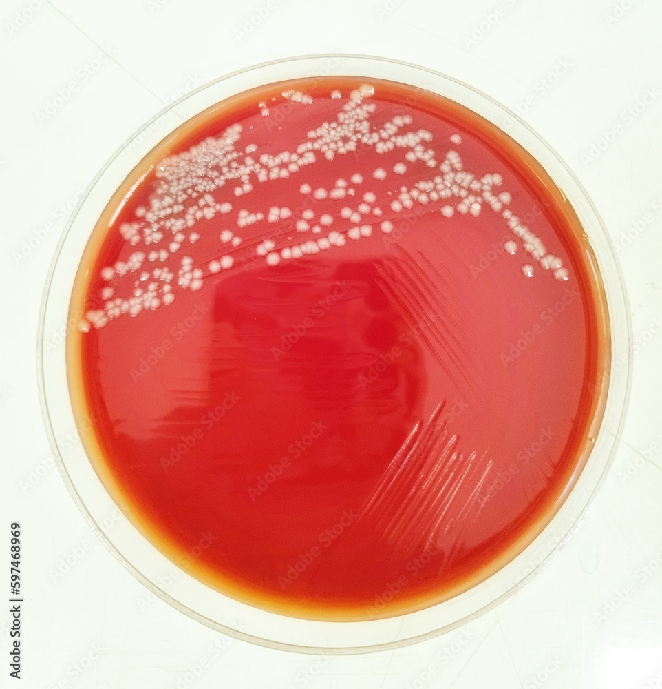 Nonhemolytic colonies on 5% sheep blood agar. Bacteria colonies in ...