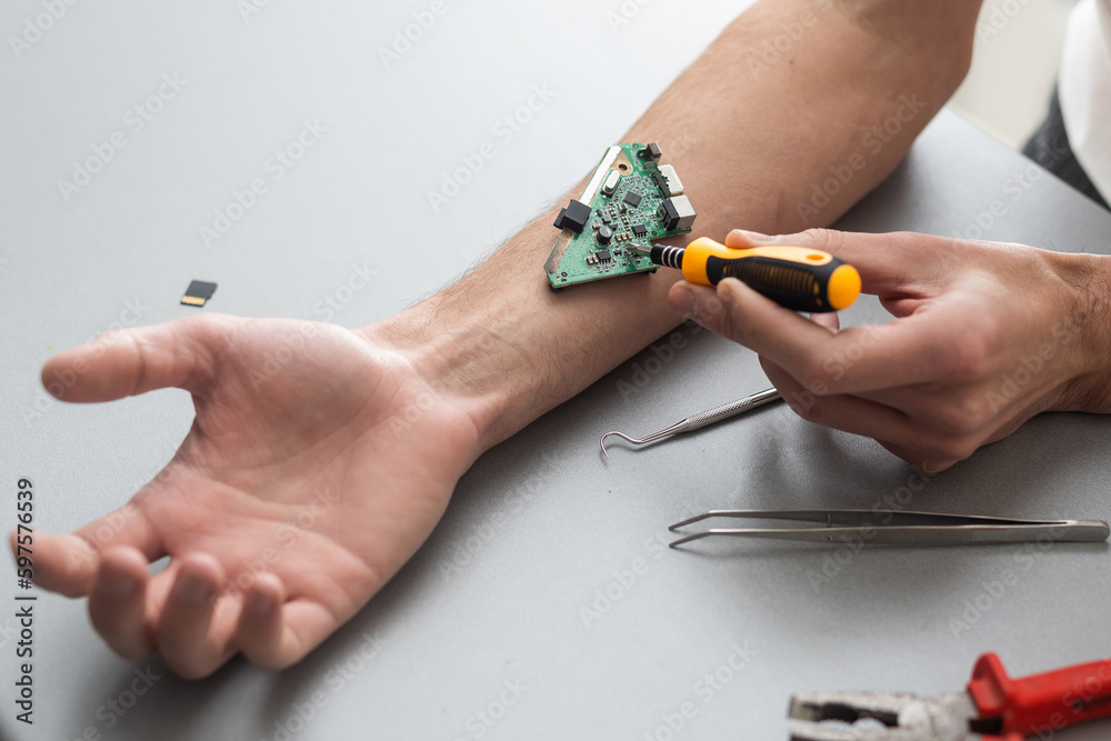Hand with implantation of micro chip. X-Ray view close-up. Chipization ...