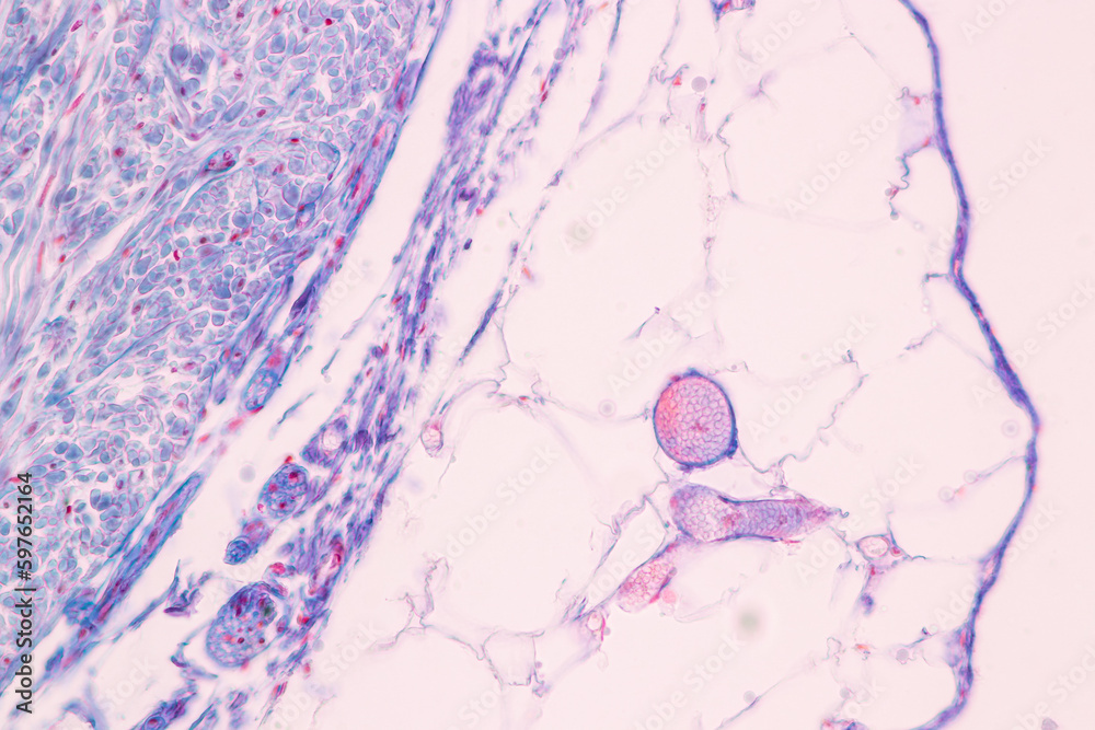 Histological Spermatic cord human, Seminal vesicle human, Prostate ...