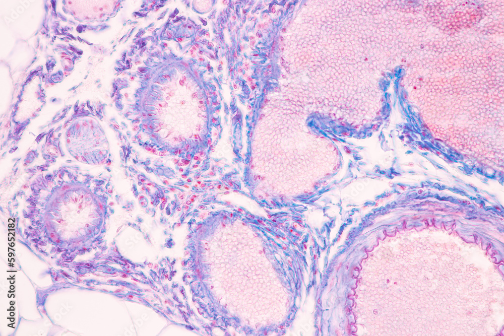 Histological Spermatic cord human, Seminal vesicle human, Prostate ...