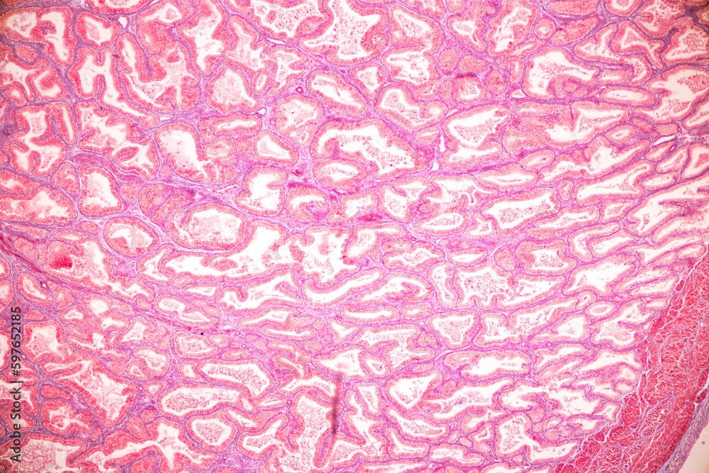 Histological Spermatic cord human, Seminal vesicle human, Prostate ...