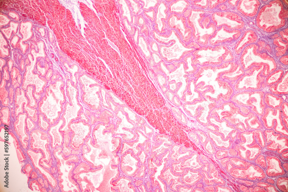 Histological Spermatic cord human, Seminal vesicle human, Prostate ...