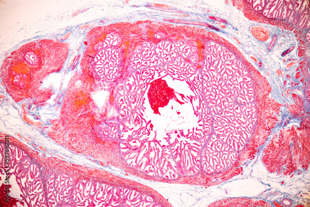 Histological Spermatic cord human, Seminal vesicle human, Prostate ...