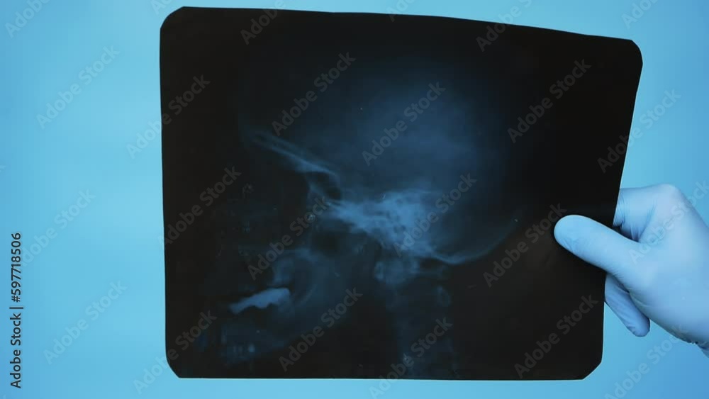 Video Stock A neurosurgeon analyzes a human cranial brain. X-ray of the ...