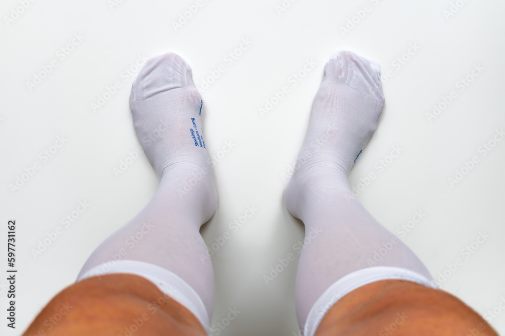 A Person Wearing A Pair Of Compression Stockings After Surgery To A Person Wearing A Pair Of Compression Stockings After Surgery To