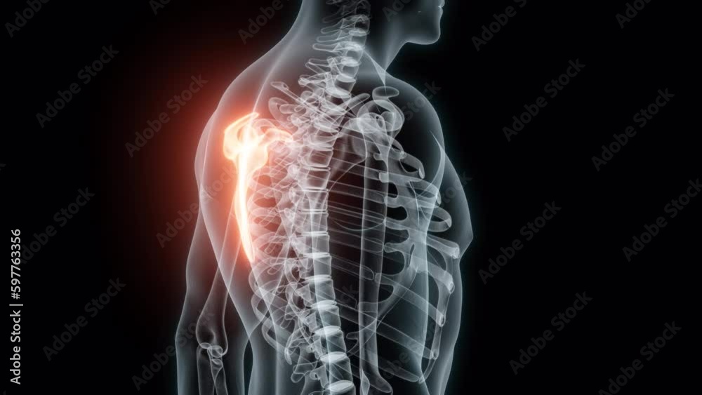 3D Rendering of a Medical Animation of the Scapula. X-ray of the ...