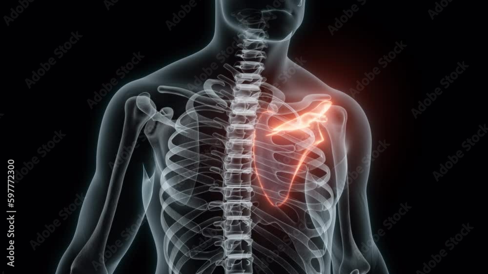 3D Rendering of a Medical Animation of the Scapula. X-ray of the ...