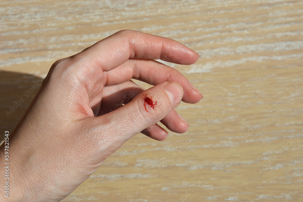 a wound on his arm, blood on his finger from a knife cut. female hands ...