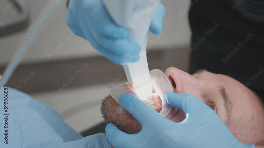 Close up: Doctor scans the teeth of a male patient in the medical ...