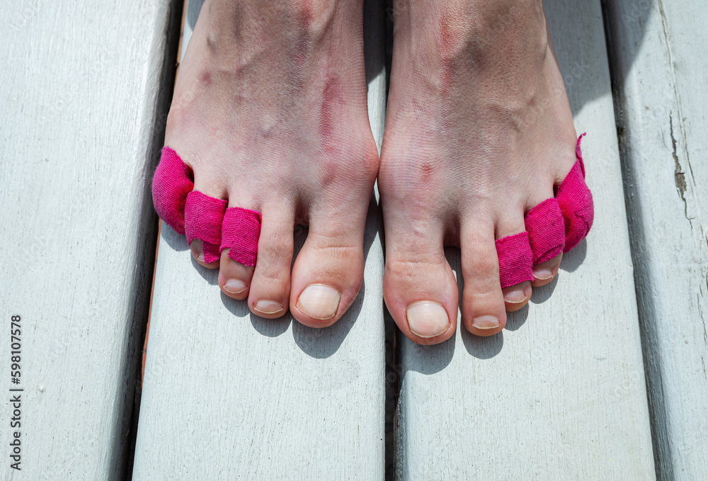 Brightly bandaged toes of a tired legs. Woman with removed shoes ...