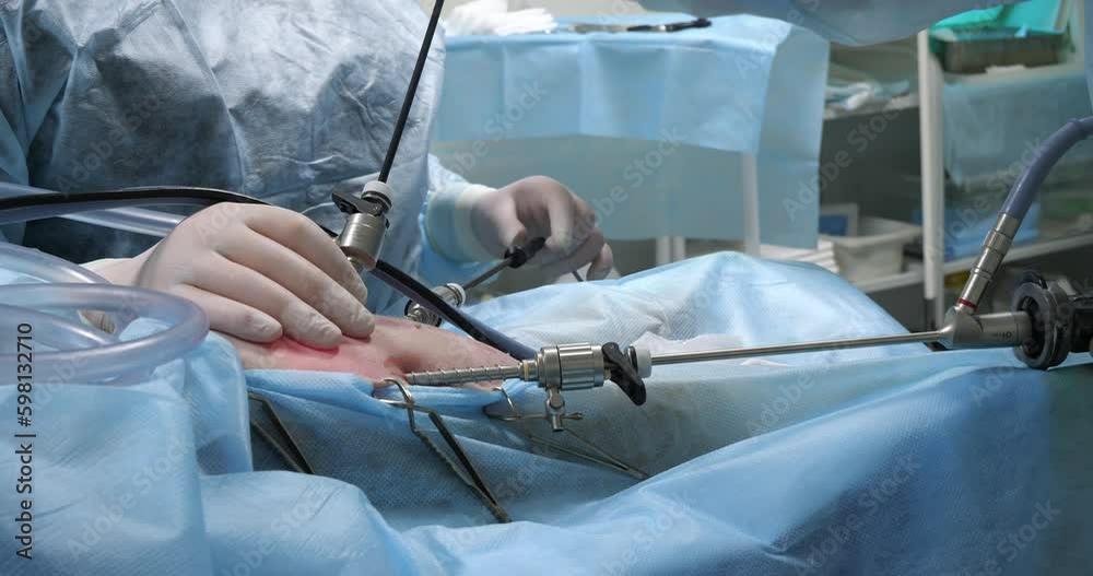 The veterinary surgeon inserts an endoscopic clamp into the port placed ...