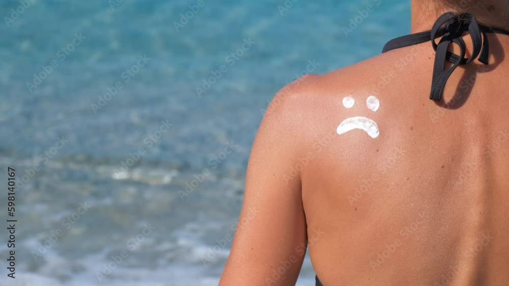 Use Sunblock On Sunburned Skin In Summer A View Of Female Sunburned