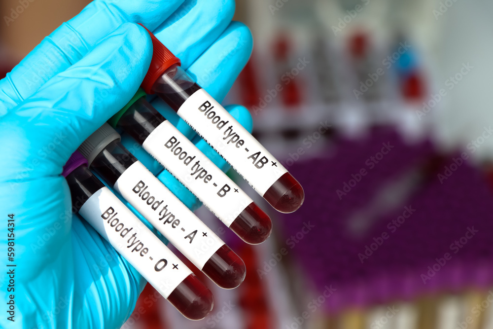Blood type Rh positive test, blood sample to analyze in the laboratory ...