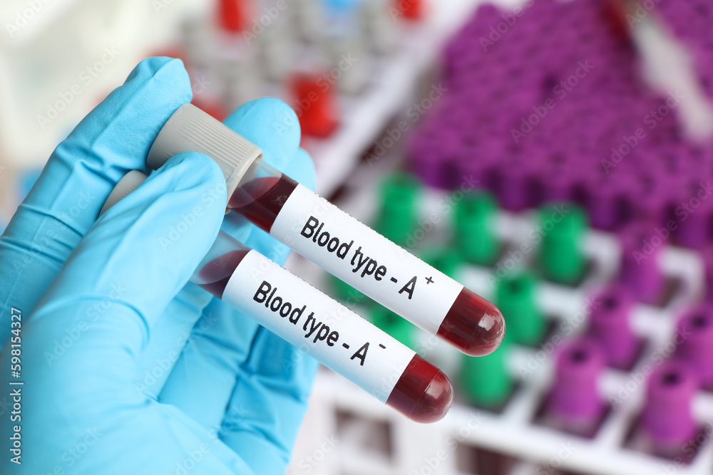 Blood type A Rh positive and negative test, blood sample to analyze in ...