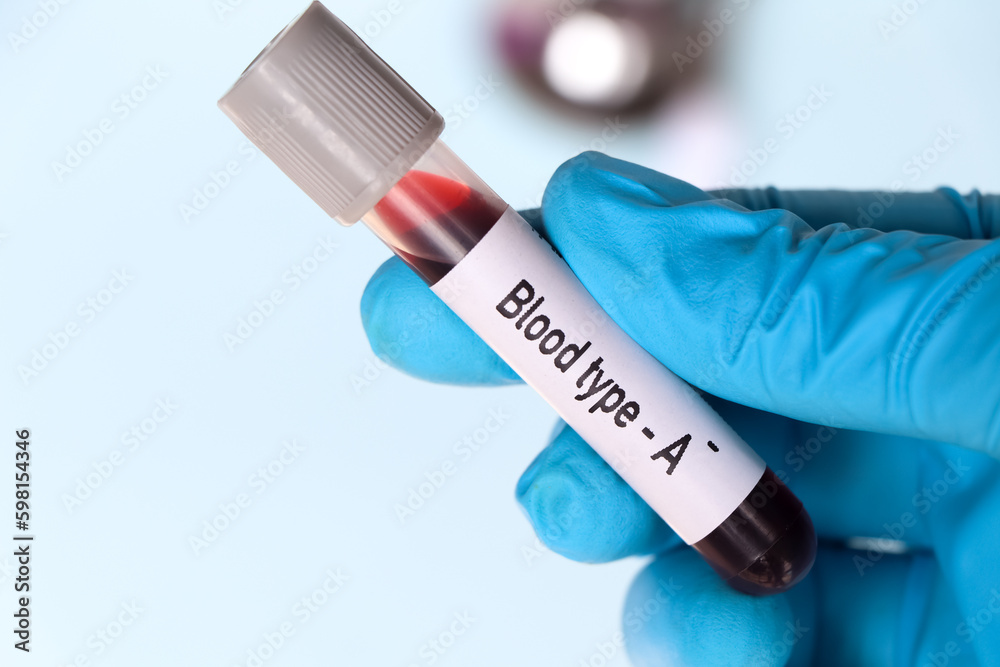 Blood type A Rh negative test, blood sample to analyze in the ...