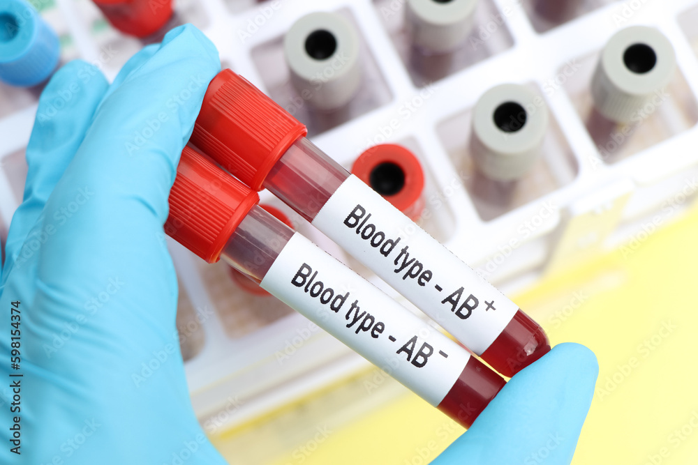 Blood type AB Rh positive and negative test, blood sample to analyze in ...