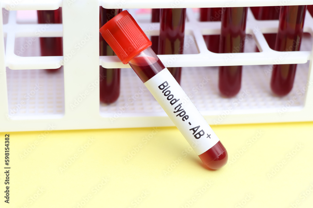 Blood type AB Rh positive test, blood sample to analyze in the ...