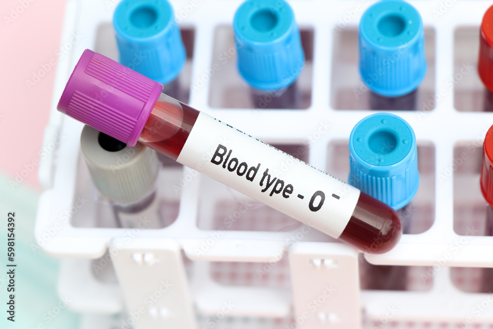Blood type O Rh negative test, blood sample to analyze in the ...