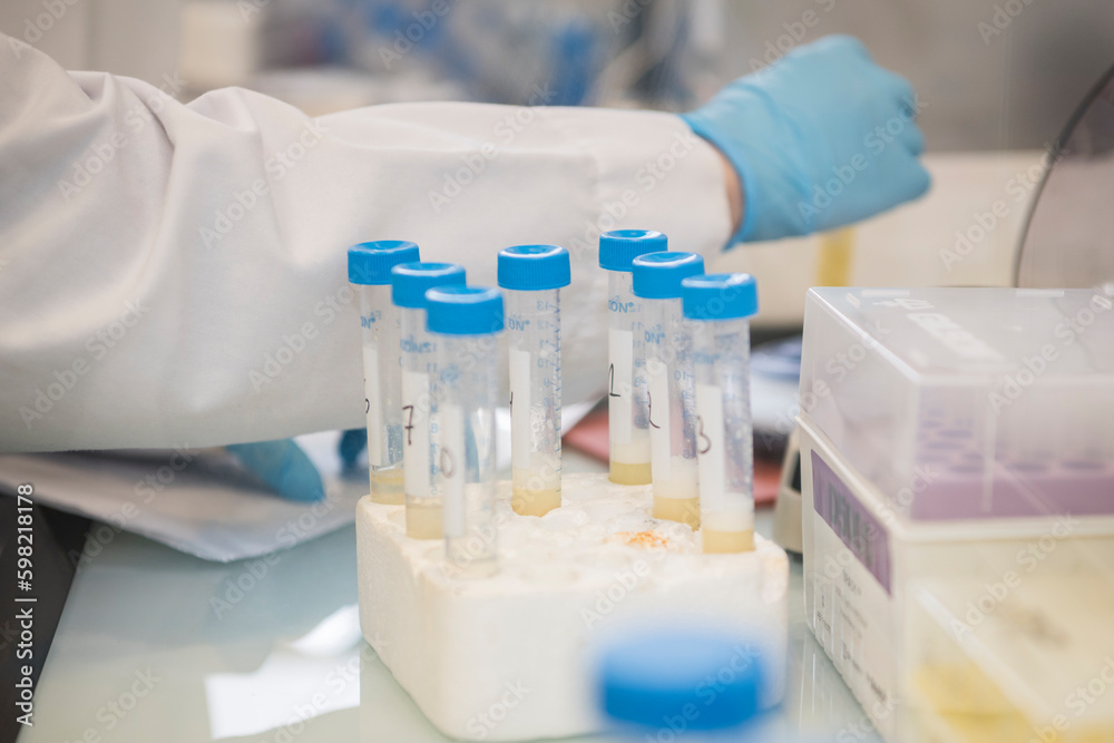 white rack with plastic test tubes in a science laboratory and an arm ...