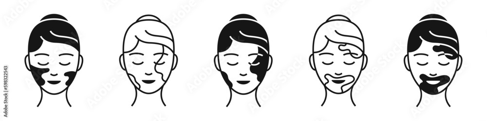 Vitiligo icon set. Girl face with spots, World Vitiligo Day Stock ...