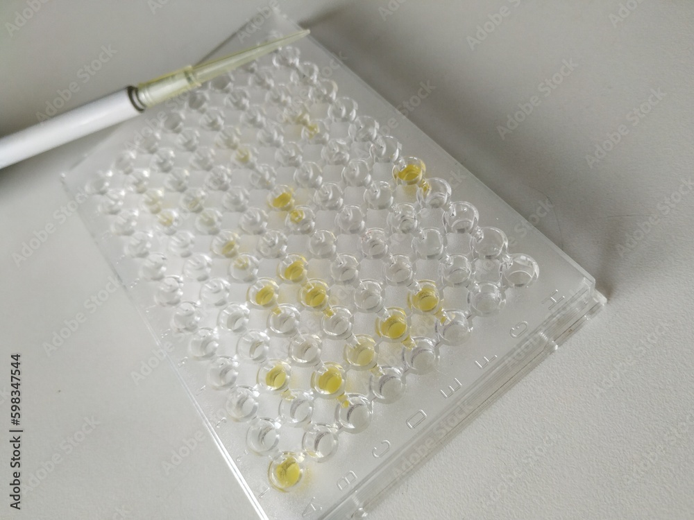 Enzyme-linked immunosorbent assay (ELISA), Immunology testing method in ...