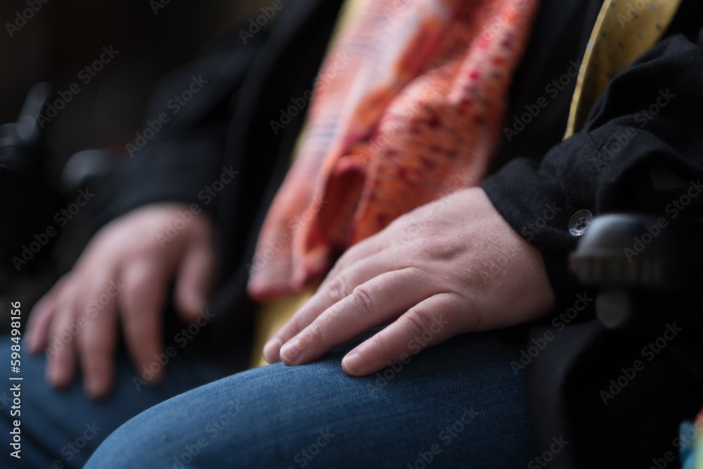 Wearing a colorful scarf and a yellow tie, a disabled transman in his ...