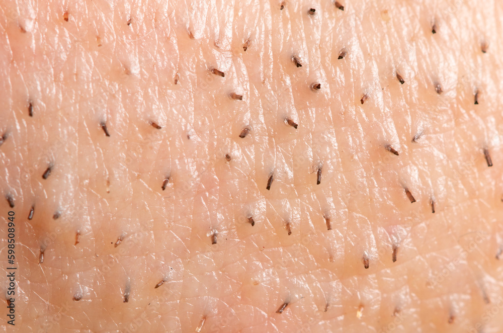 Foto de Small hairs on the skin of a man's face. Macro. do Stock ...