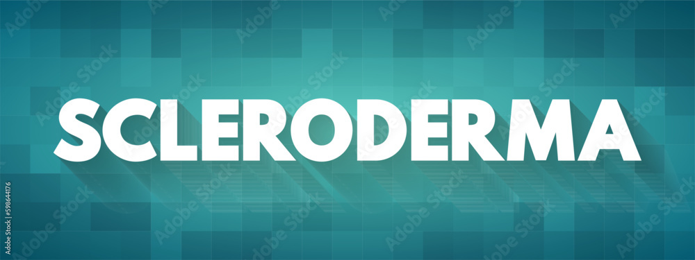 Scleroderma - autoimmune connective tissue and rheumatic disease that ...