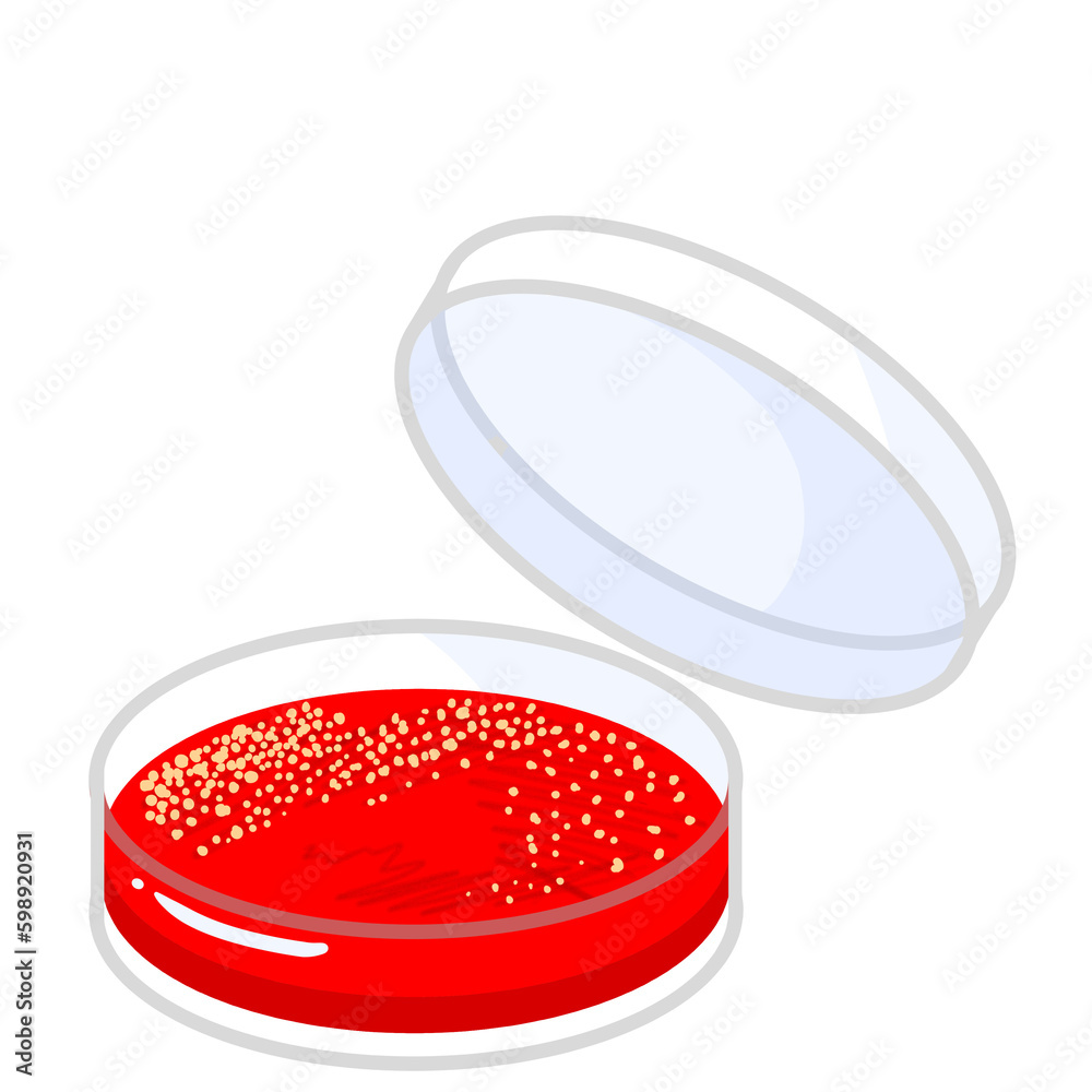 The isolation of bacteria on agar plates. Lactose fermenters turn red ...