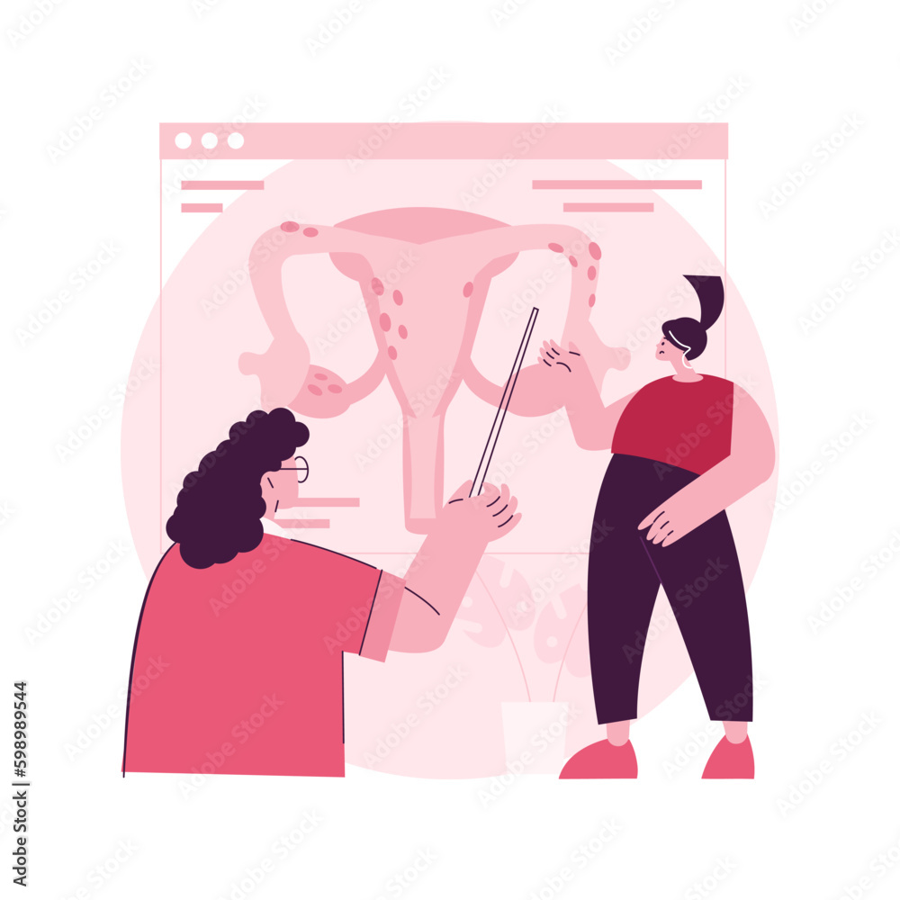 Endometriosis abstract concept vector illustration. Endometrium ...
