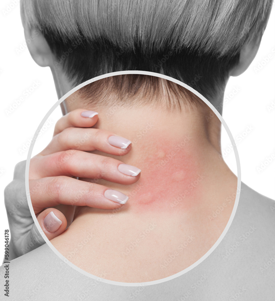 Girl with blond hair, sitting with his back turned and scratching ...