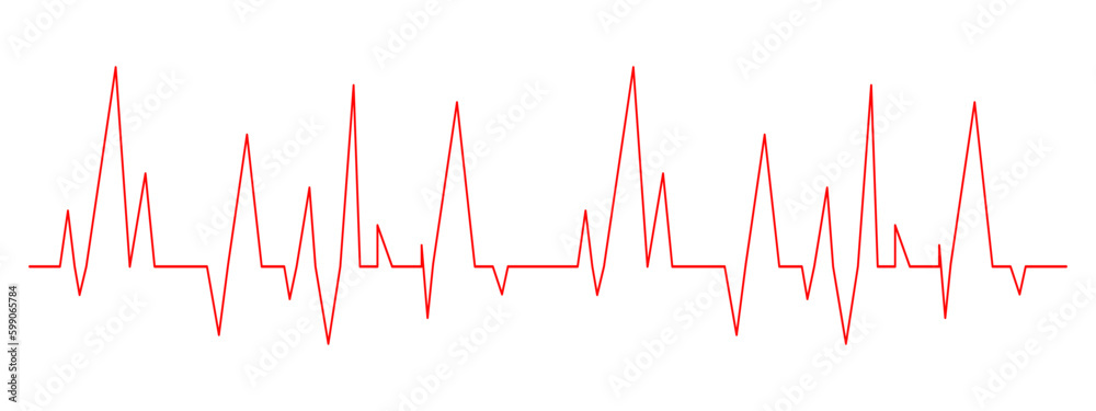 Vecteur Stock Heart beat chart. ECG diagram isolated on white ...