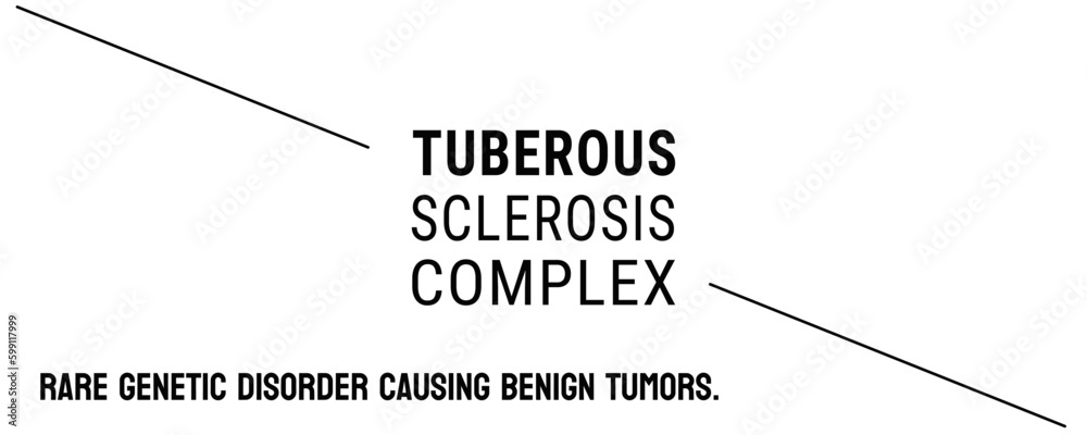 Tuberous Sclerosis Complex: A genetic disorder causing benign tumors to ...