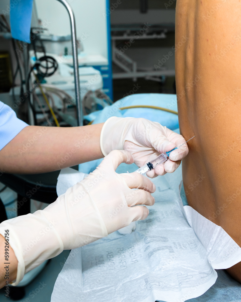 Injection of epidural anesthesia into the patient's spine. Preparation ...