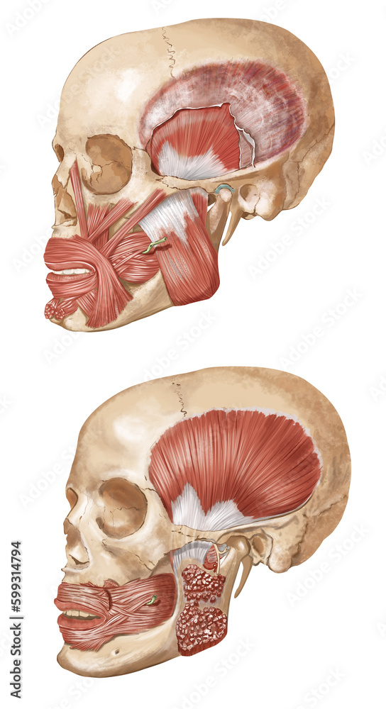Human chewing muscles medical illustration, anatomy poster Stock ...