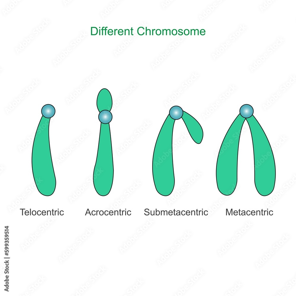 Type of chromosome. Metacentric, Submetacentric, Acrocentric ... Type of chromosome. Metacentric, Submetacentric, Acrocentric ...