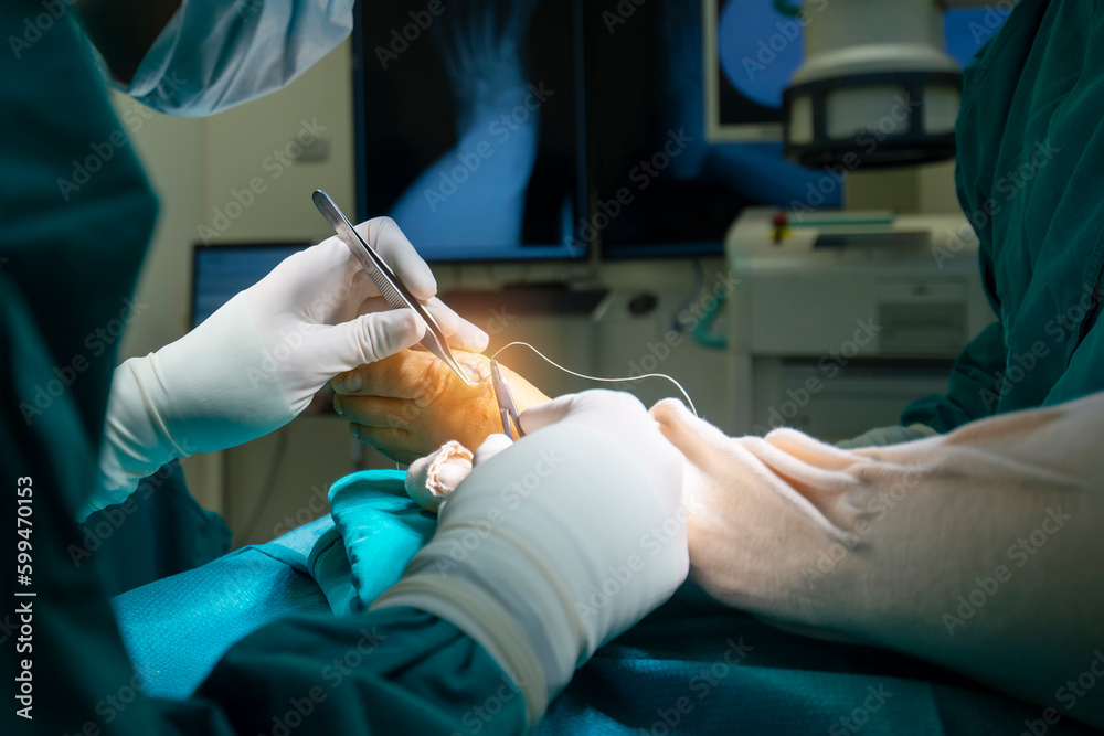 Hand of doctor or surgeon did foot surgery inside an operating room in ...