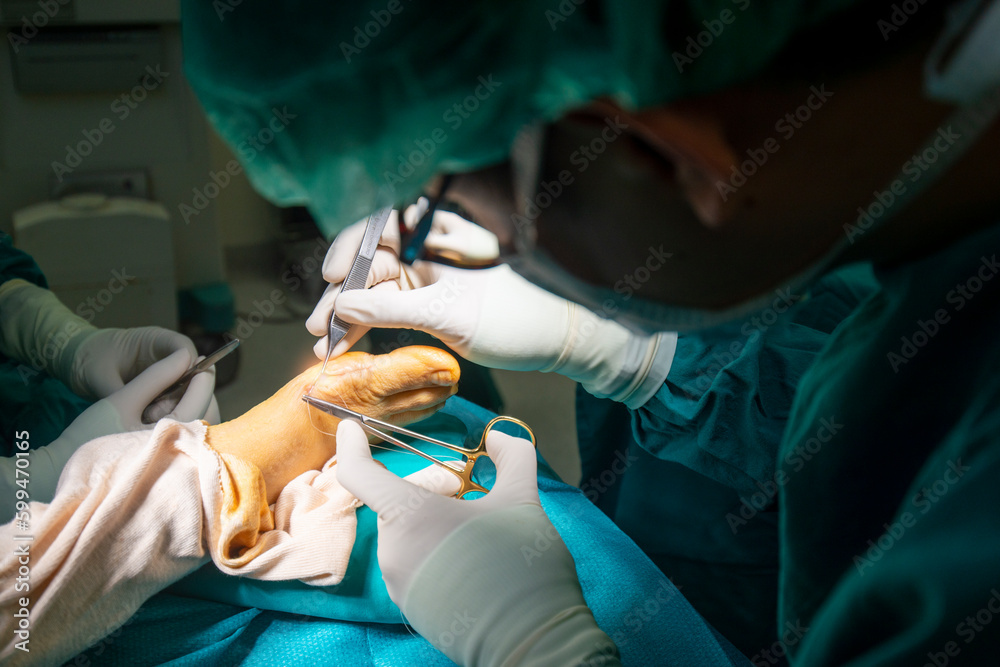 Hand of doctor or surgeon did foot surgery inside an operating room in ...
