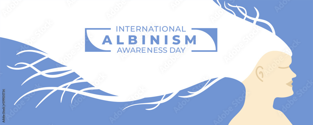 International Albinism Awareness Day on 13 June Banner Background ...