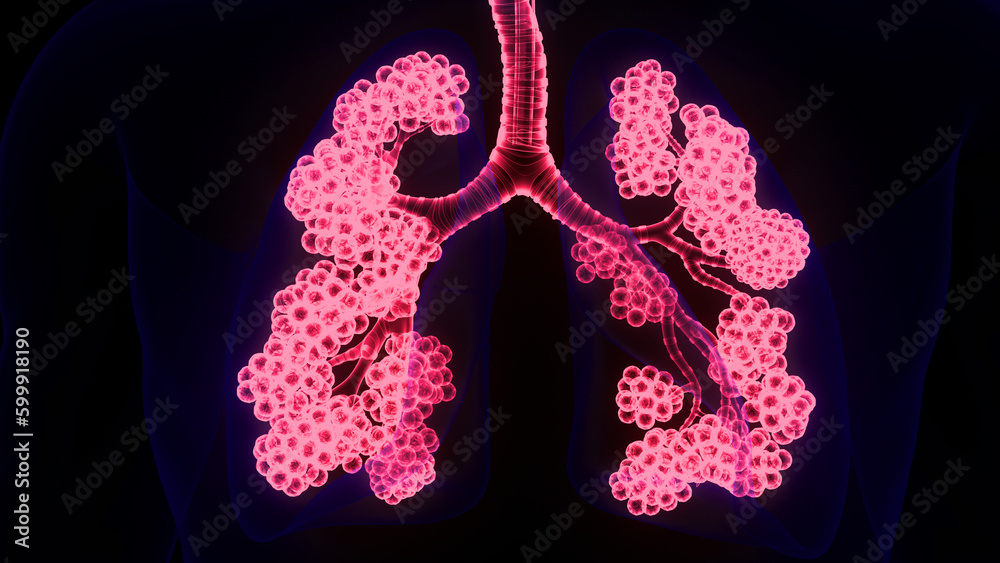 Human Respiratory System Lungs with Alveoli Anatomy Stock Illustration ...