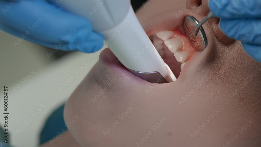 Doctor scans the patient's teeth in the clinic. The dentist holds in ...