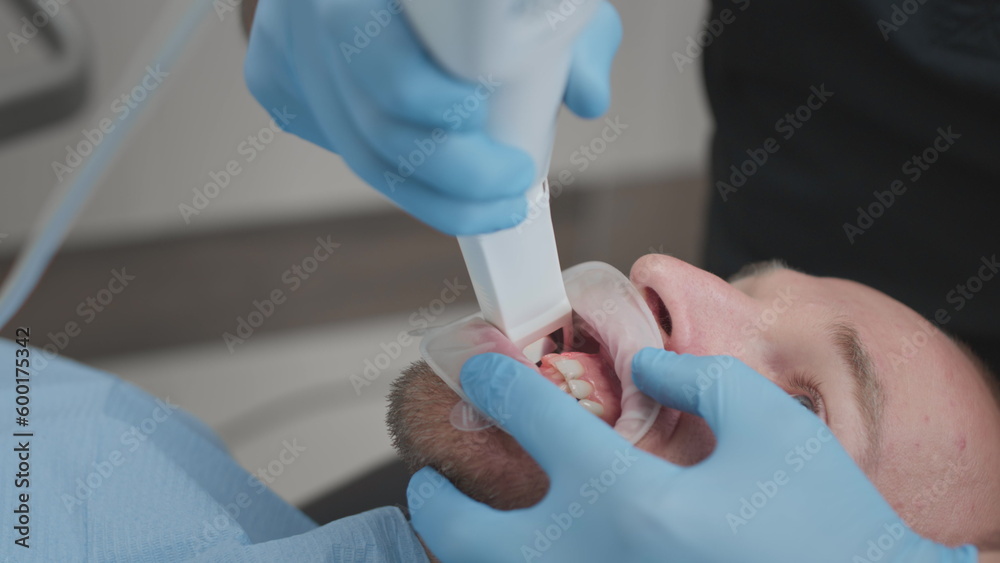 Close up: Doctor scans the teeth of a male patient in the medical ...