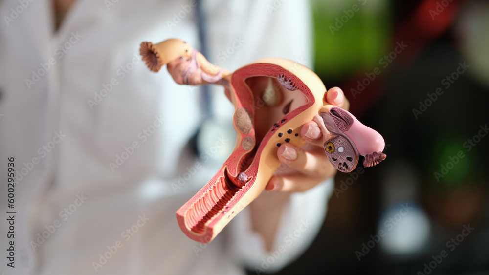 Woman gynecologist holding anatomical model of uterus and ovaries Stock ...