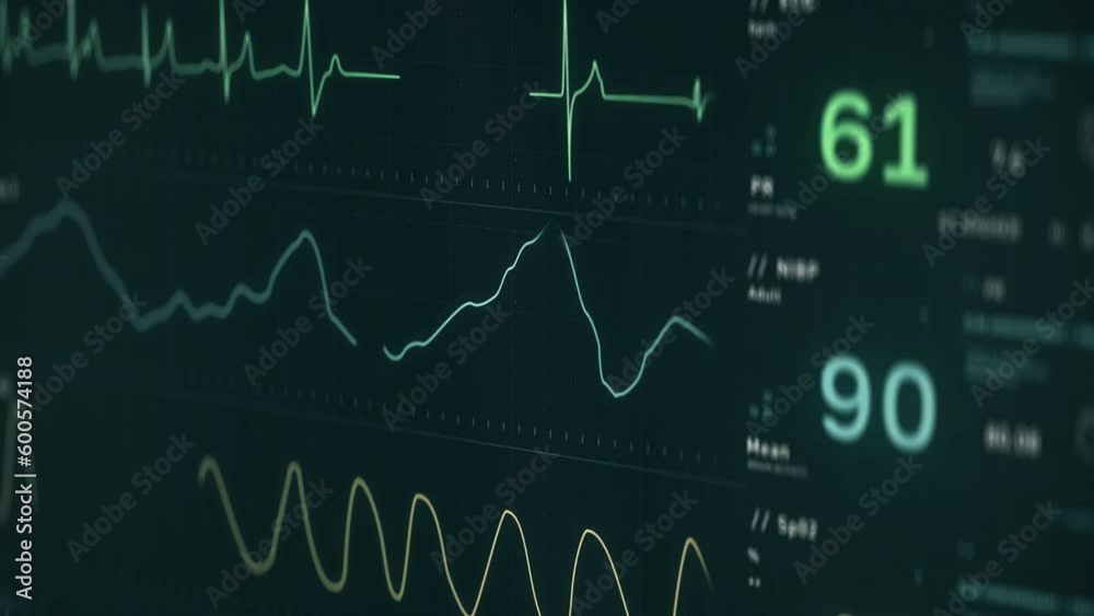 Graph of the vital life signs of an emergency sick patient. Vital graph ...
