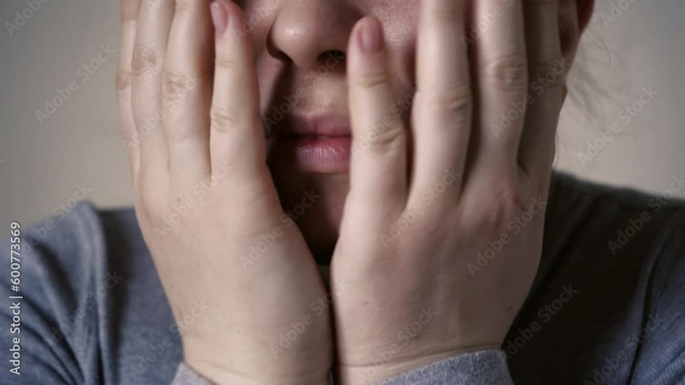Close up of skin problems, unhealthy skin with acne and pimples. Porous ...
