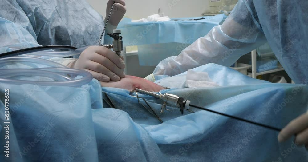 Veterinary surgeon performs endoscopic abdominal surgery on a pet in ...