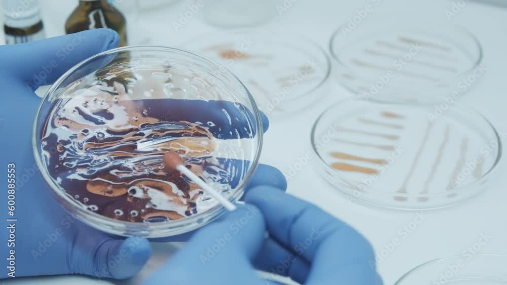Bacteria culture growth on a petri dish in microbiology lab. Candida ...