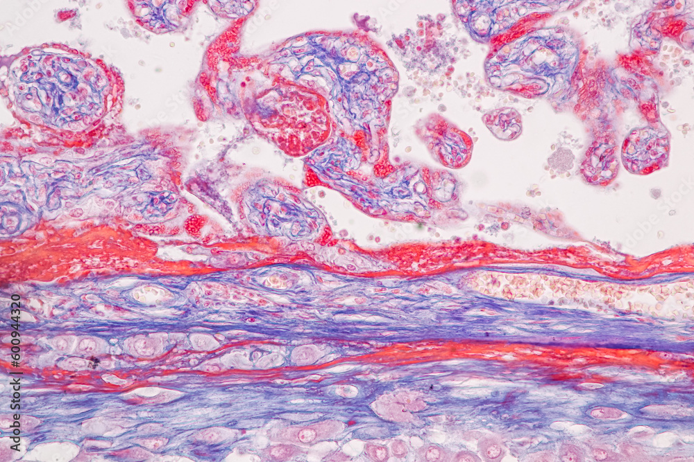 Histological Uterus human, Uterine tube human, Placenta human and ...